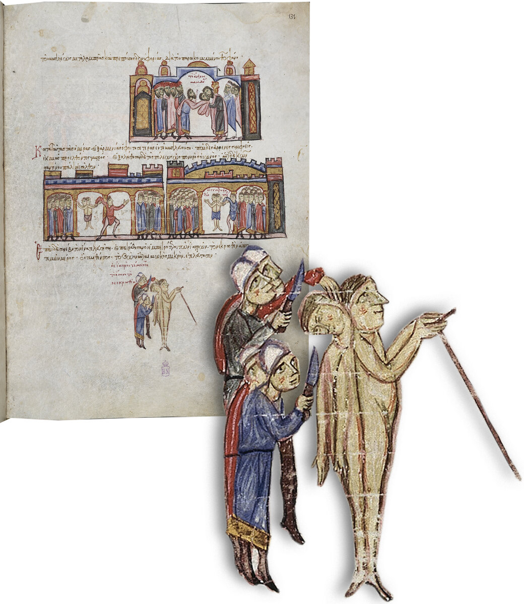 Before Dr. Tulp: a Medieval Surgeon's manual : Medieval Text Manuscripts